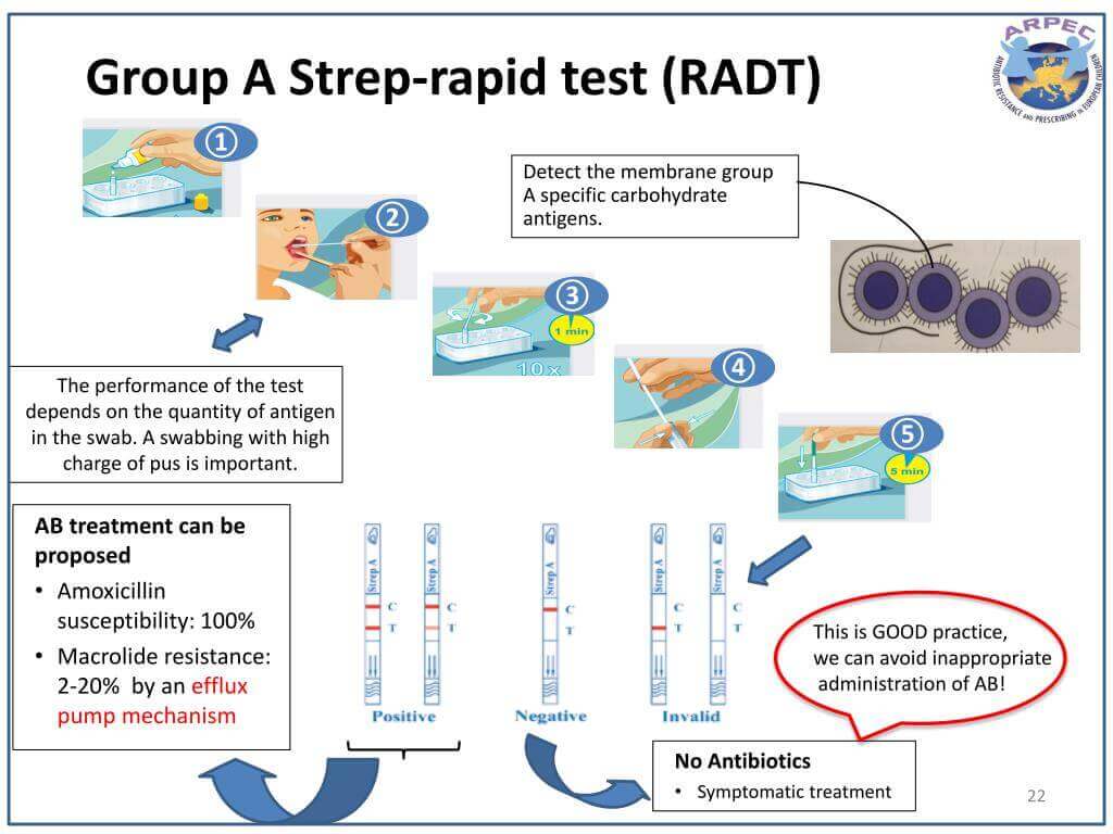 Rapid Strep Test Mechanism Rapid Strep Test Mechanism